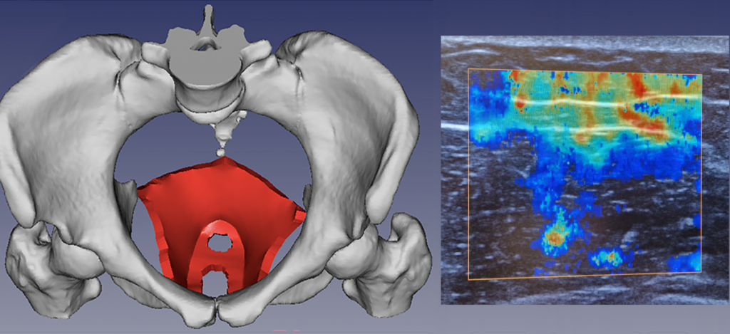 PelvicMIM – A Multimodal Imaging Matrix for enhanced diagnosis and ...